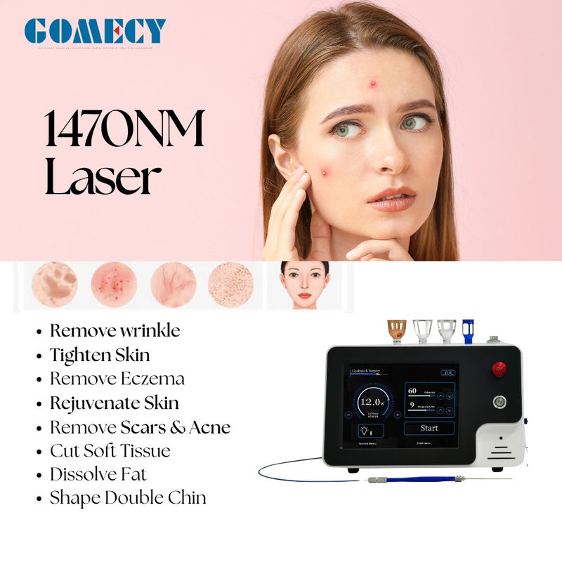 Endolift Laser Machine With 1470nm Powerful Energy For Face Lift Double ...