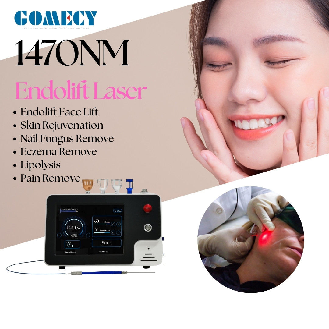 1470nm Endolift Laser Face Lift Double Chin Shape 15W 20W Fat Cellulite ...