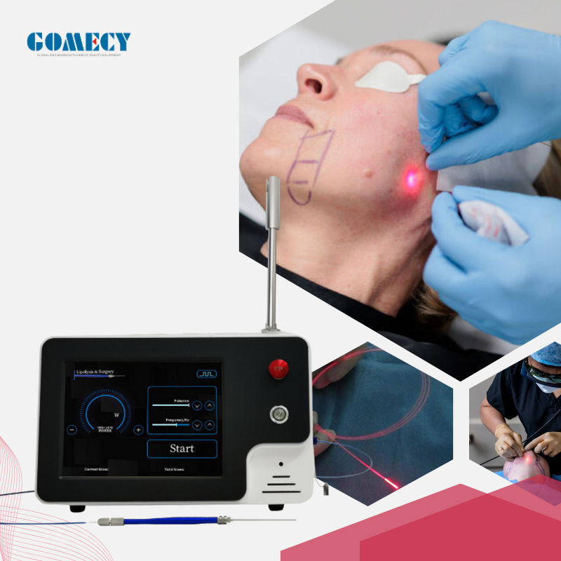 980 1470nm Diode Laser Body Sculpting Machine for Fat Melting and Skin ...